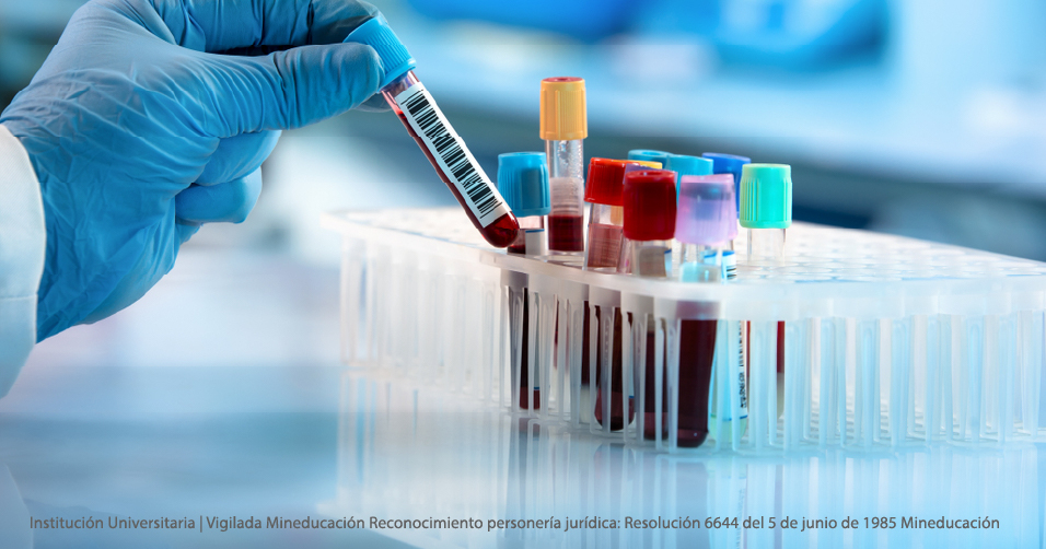 Toma de muestras de laboratorio